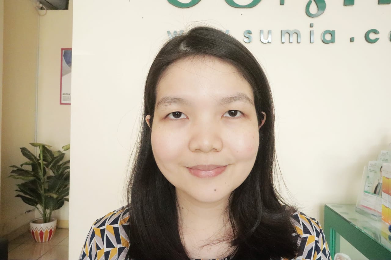 Nyobain Laser Muka di SUMIA Aesthetic Clinic – Dessy Donat